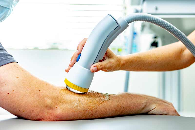 The Top 10 Conditions SoftWave Therapy Can Transform – And Why Your ...